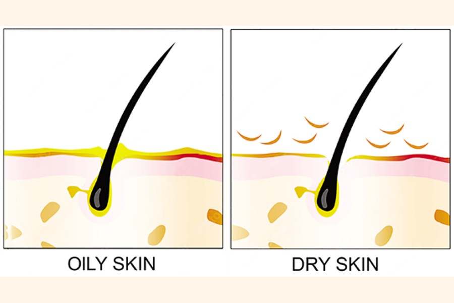 Dry skin despite moisturising: What to do? | The Financial Express